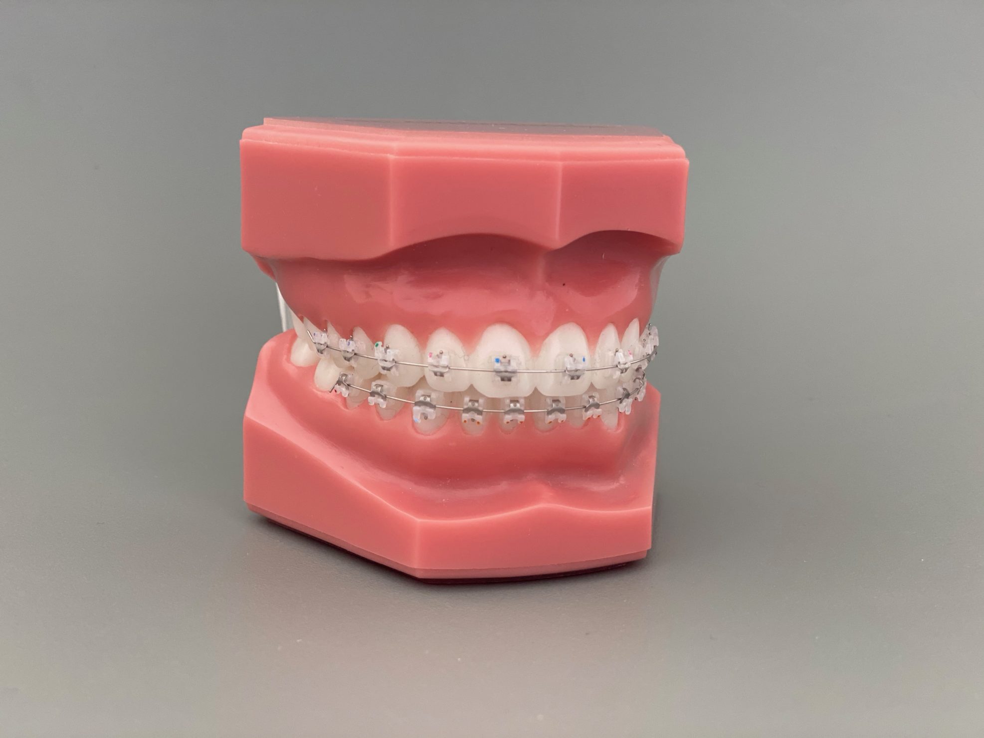 Fixed Braces - Kieferorthopädisches Zentrum Zürich